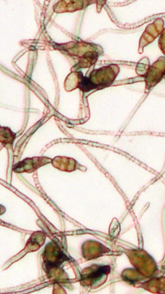 Soorten schimmels in huis - Dolmans