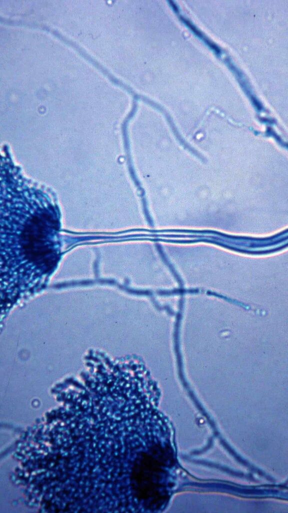 Soorten schimmels in huis - Dolmans